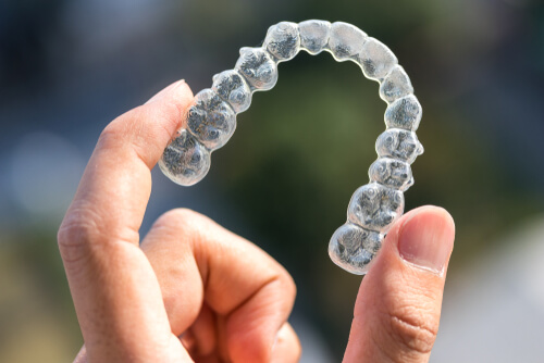 What is an Invisalign Passive Aligner | soapgoddess.com