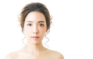 How to Turn Sunburn into Tan: Effective Tips | Soap Goddess